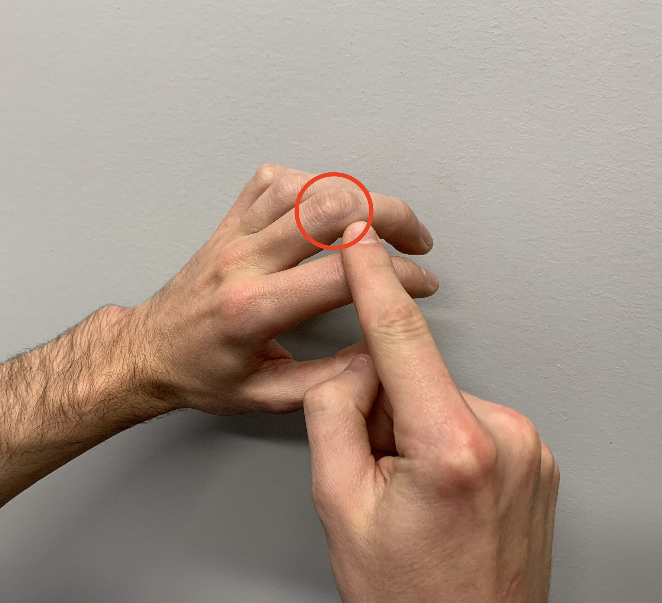 How to Identify a Finger Growth Plate Injury in Youth Rock Climbers ...